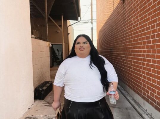 Is Al Weezy trans? Before and after transition